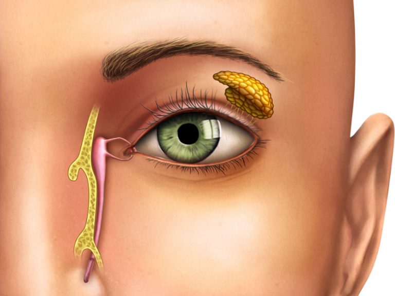 Watery eye - Dr Tom Cunneen - Eye Surgery Perth